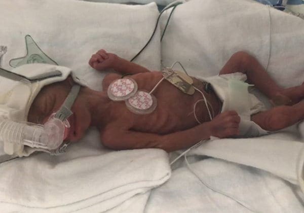 'Miracle Baby' Born Weighing Just 1 Pound Goes Home After 104 Days in ...