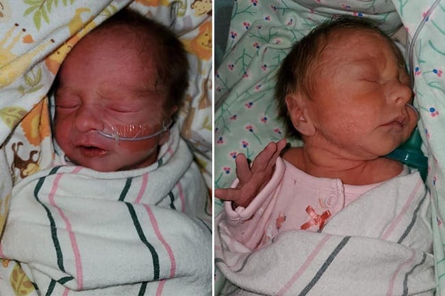 Twins born different decades | For Every Mom